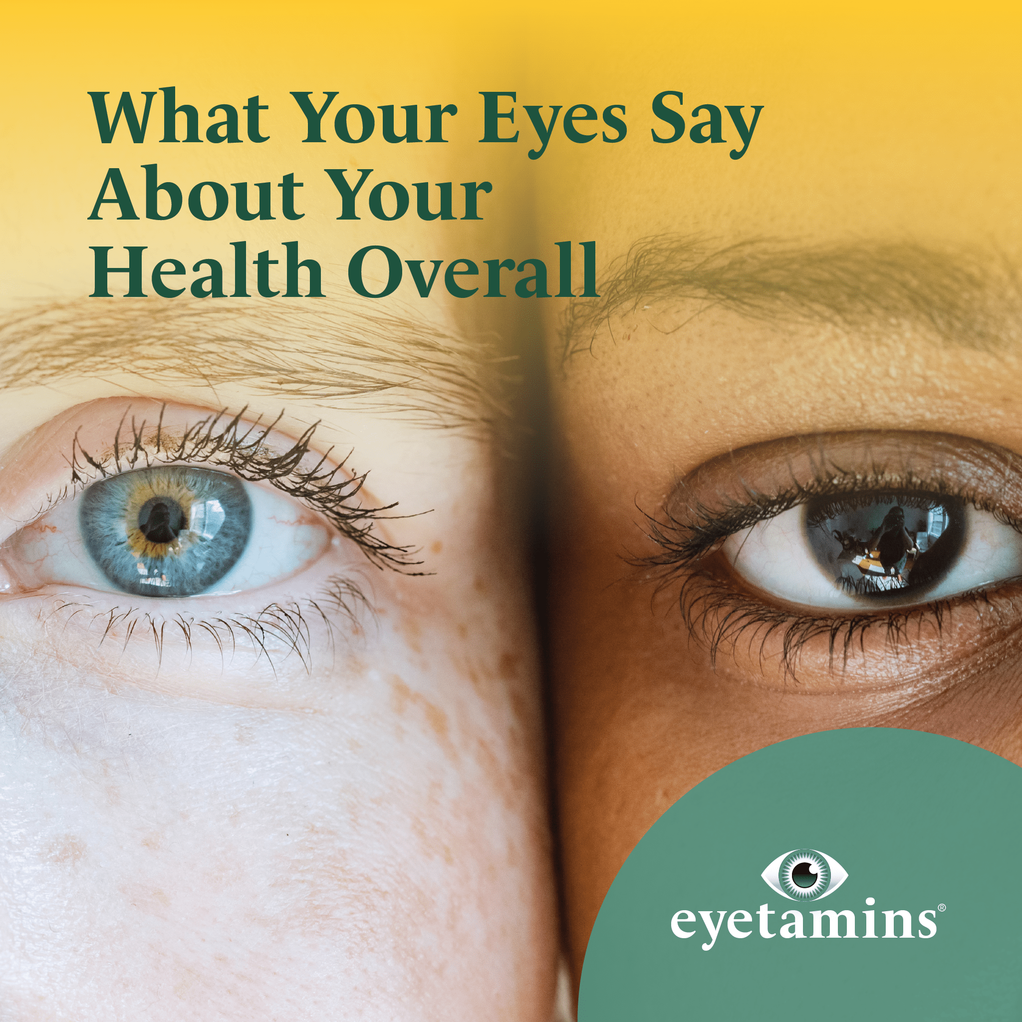 What Your Eyes Say About Your Health Overall – Eyetamins